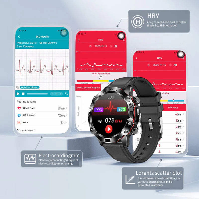 ECG Smartwatch