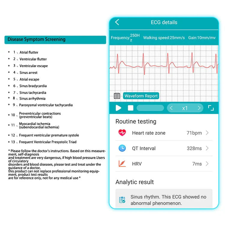 ECG Smartwatch